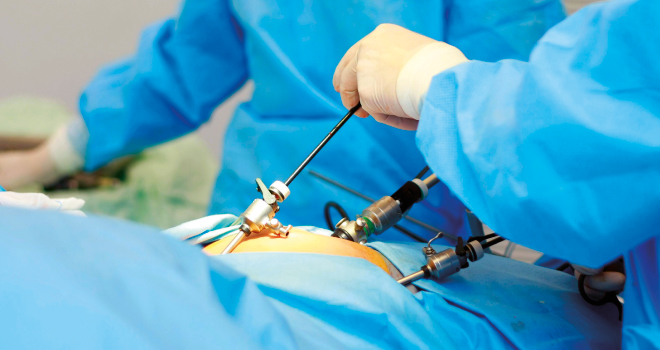 ΕΝΔΟΣΚΟΠΙΚΗ ΚΑΙ ΑΝΟΙΧΤΗ ΧΕΙΡΟΥΡΓΙΚΗ - Δημήτρης Καμπούρης